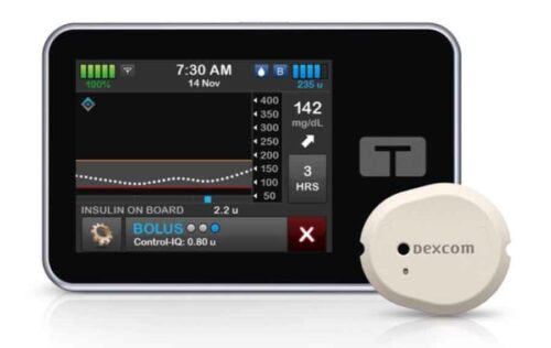 Das Dexcom G7 rtCGM-System ist jetzt mit der Tandem t:slim X2 ...
