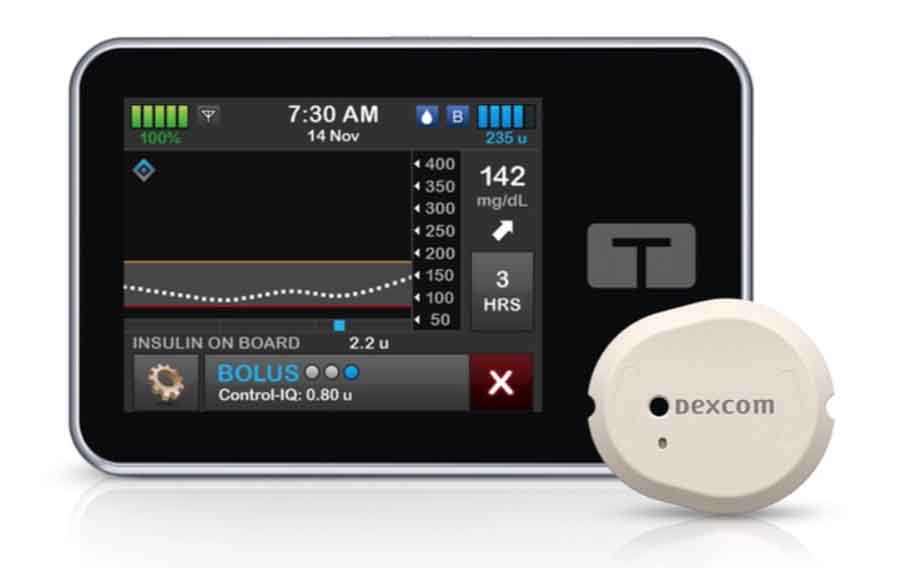 Das Dexcom G7 rtCGM-System ist jetzt mit der Tandem t:slim X2 ...